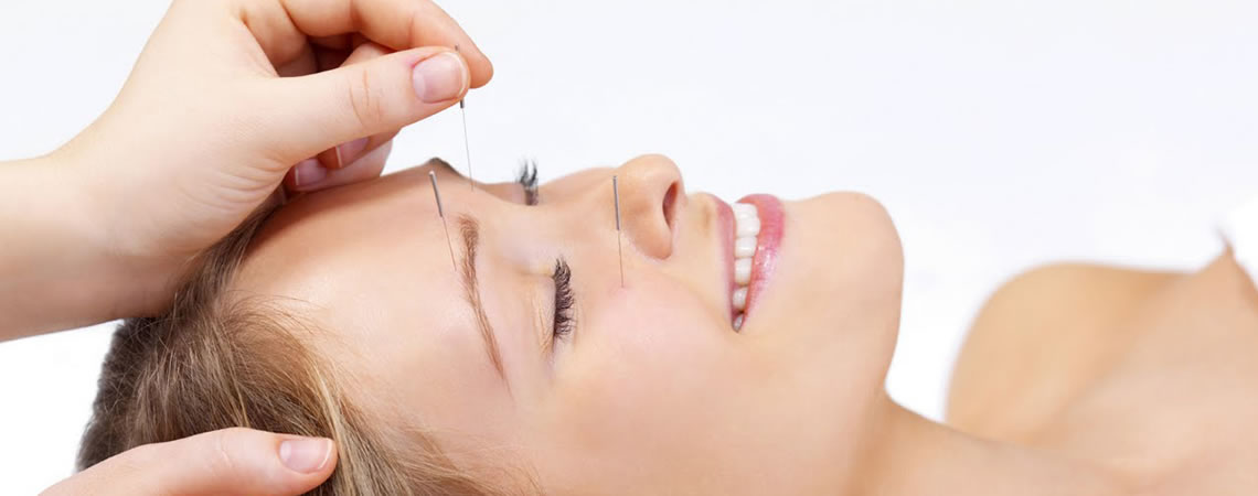 Cosmetic Acupuncture - TCM Acupuncture